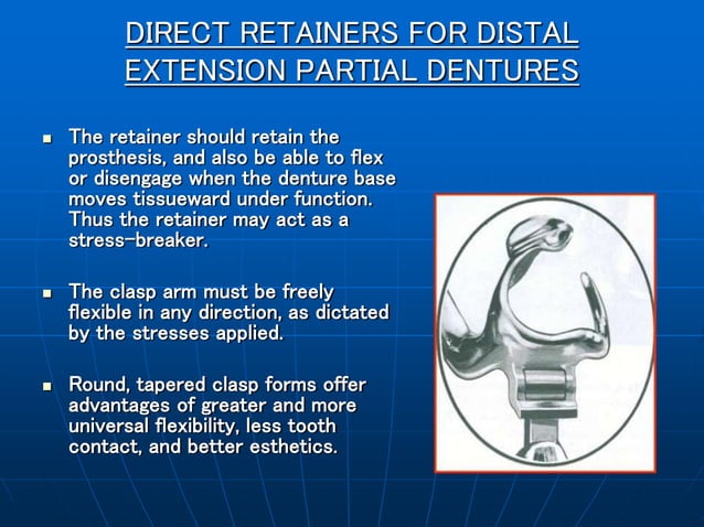 Principles of rpd design | PPT