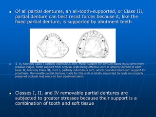 Principles of rpd design | PPT
