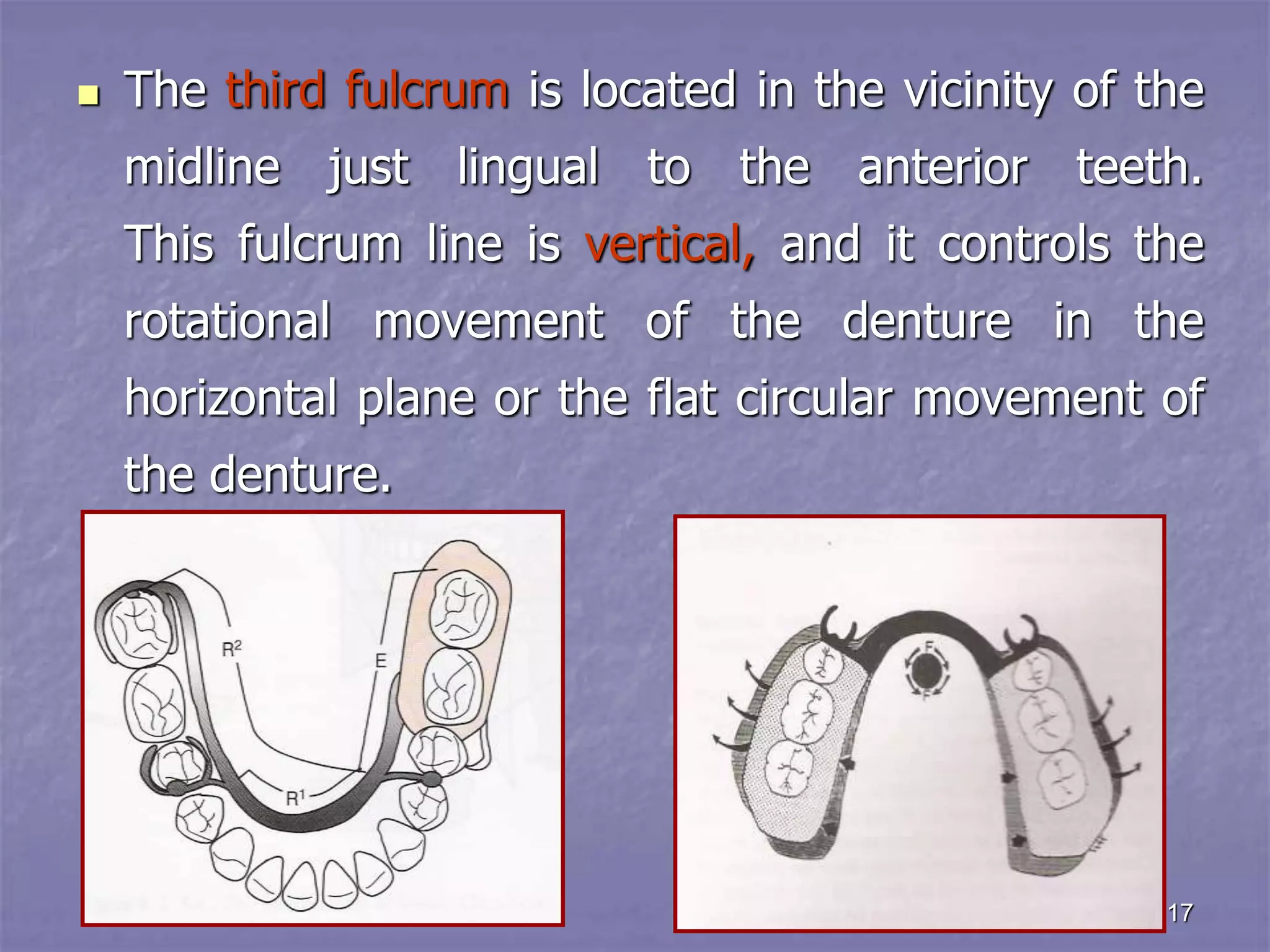 principles of rpd design.ppt