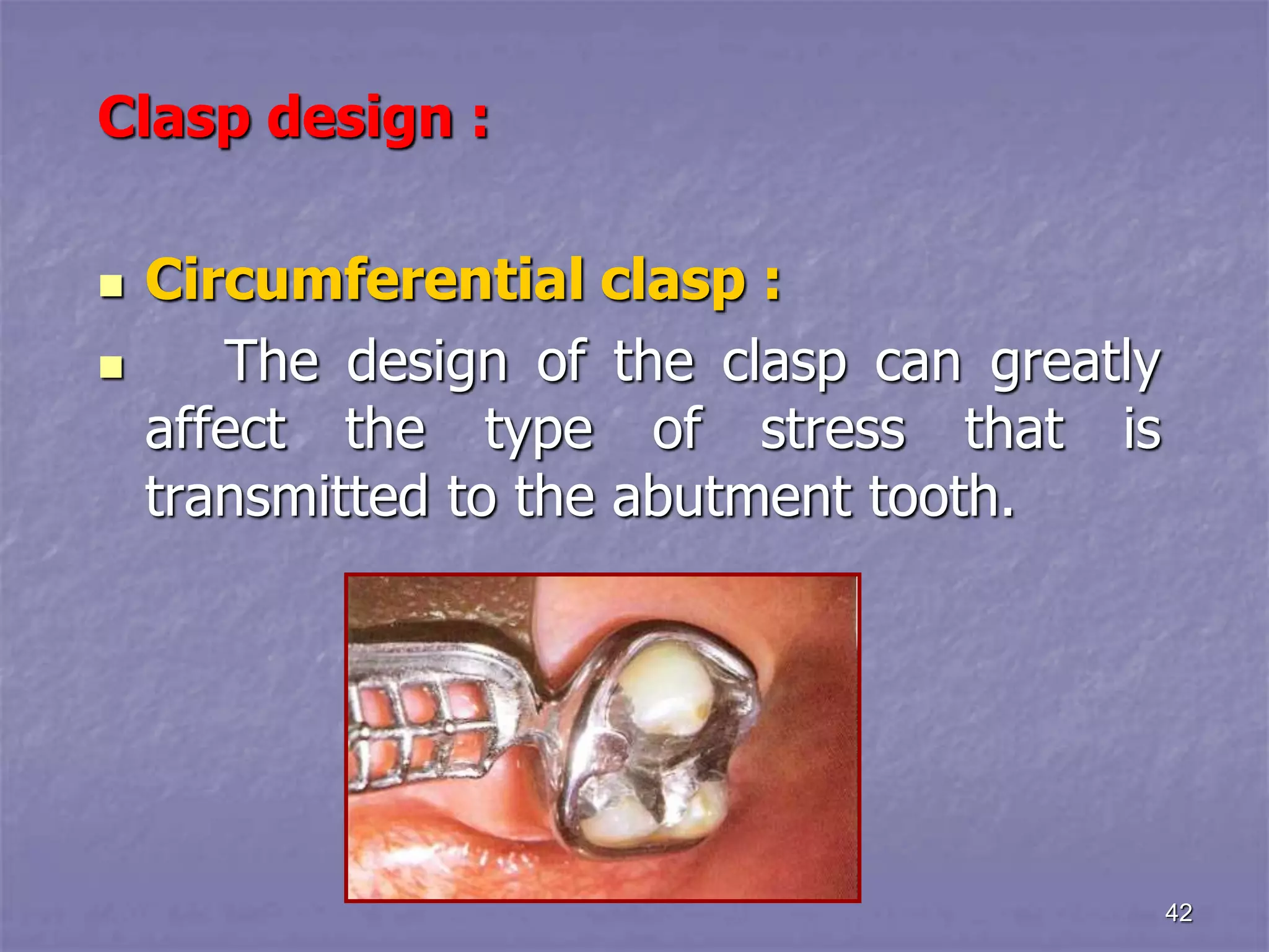 principles of rpd design.ppt | Dental Health | Diseases and Conditions