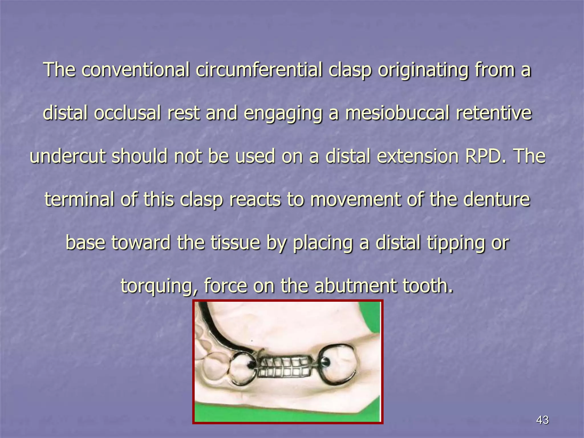 principles of rpd design.ppt