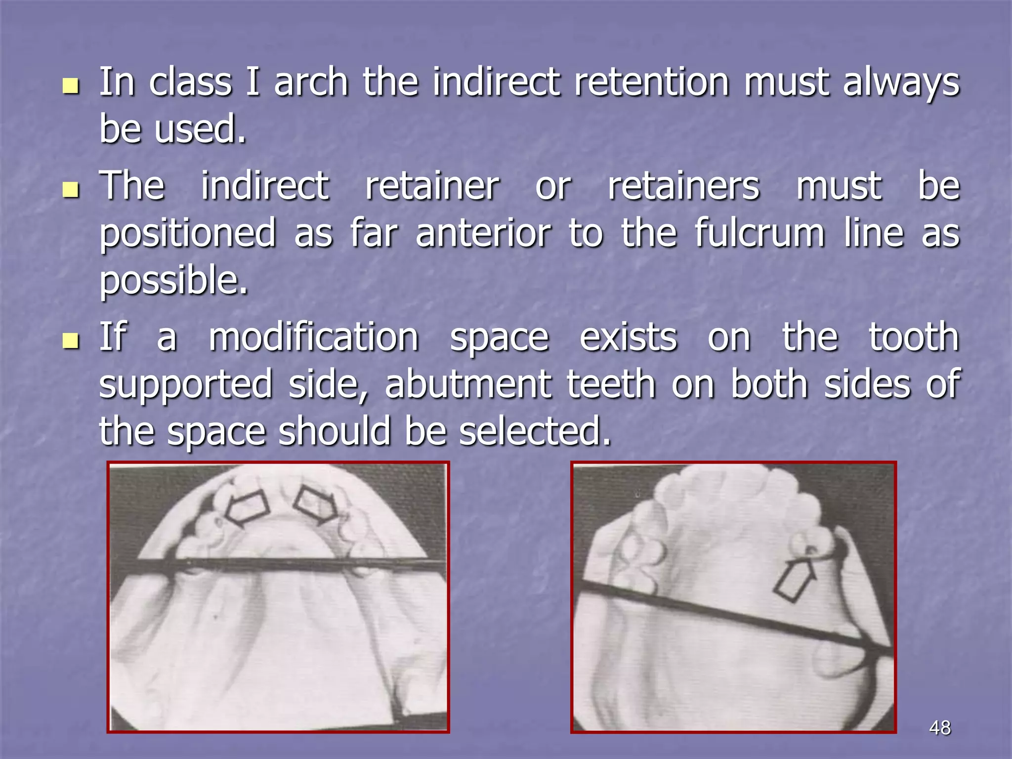 principles of rpd design.ppt | Dental Health | Diseases and Conditions