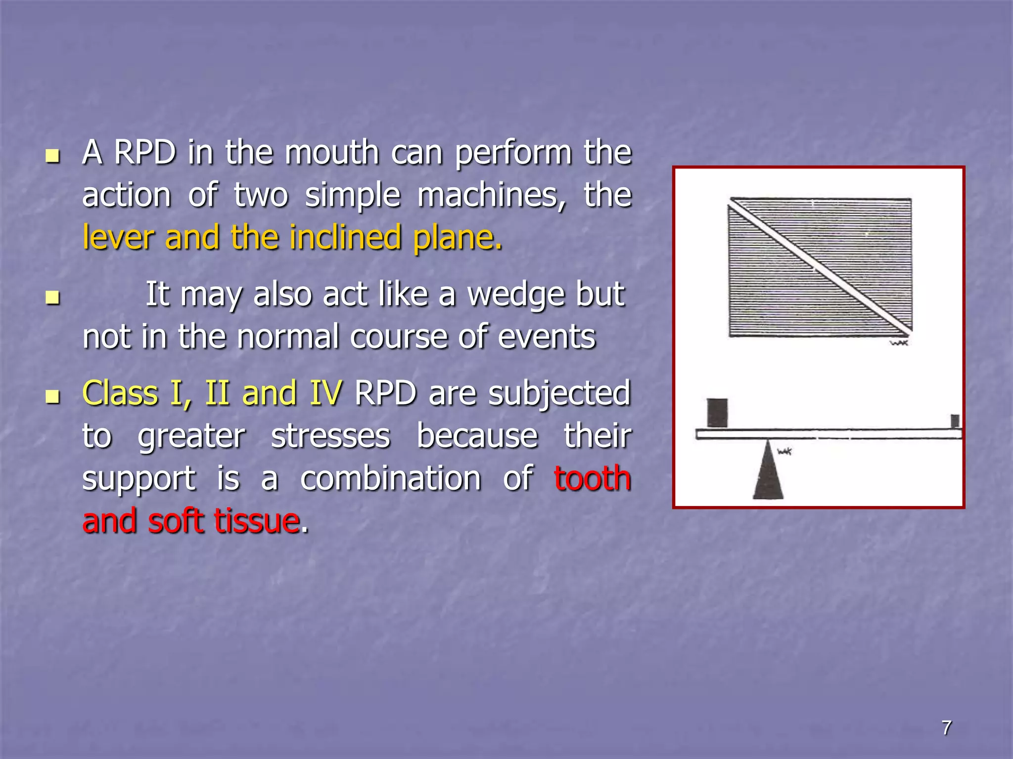 principles of rpd design.ppt