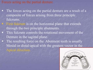 principles of rpd design.ppt