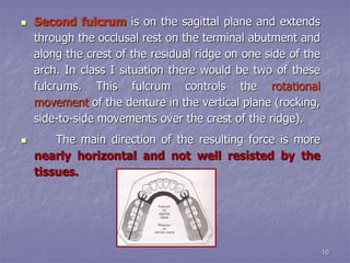 principles of rpd design.ppt