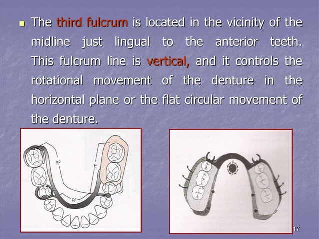 principles of rpd design.ppt | Dental Health | Diseases and Conditions