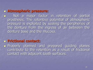 principles of rpd design.ppt