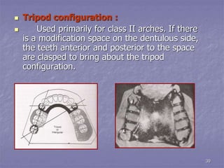 principles of rpd design.ppt