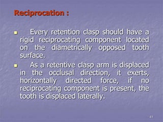 principles of rpd design.ppt
