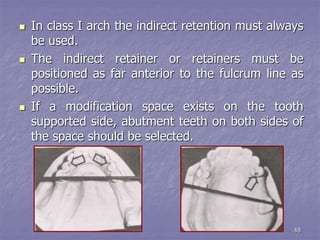 principles of rpd design.ppt