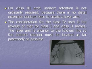 principles of rpd design.ppt