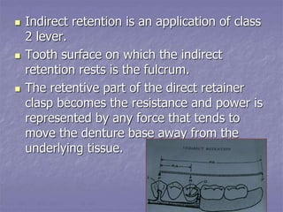 principles of rpd design.ppt