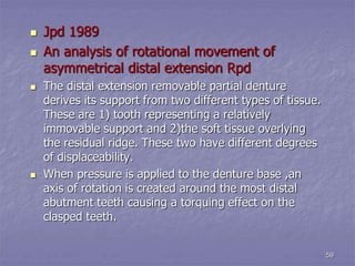principles of rpd design.ppt