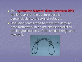 principles of rpd design.ppt