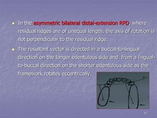 principles of rpd design.ppt