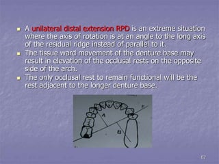 principles of rpd design.ppt