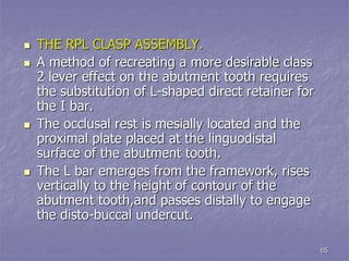 principles of rpd design.ppt
