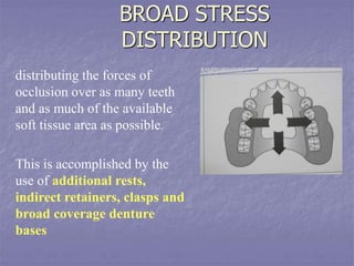 principles of rpd design.ppt