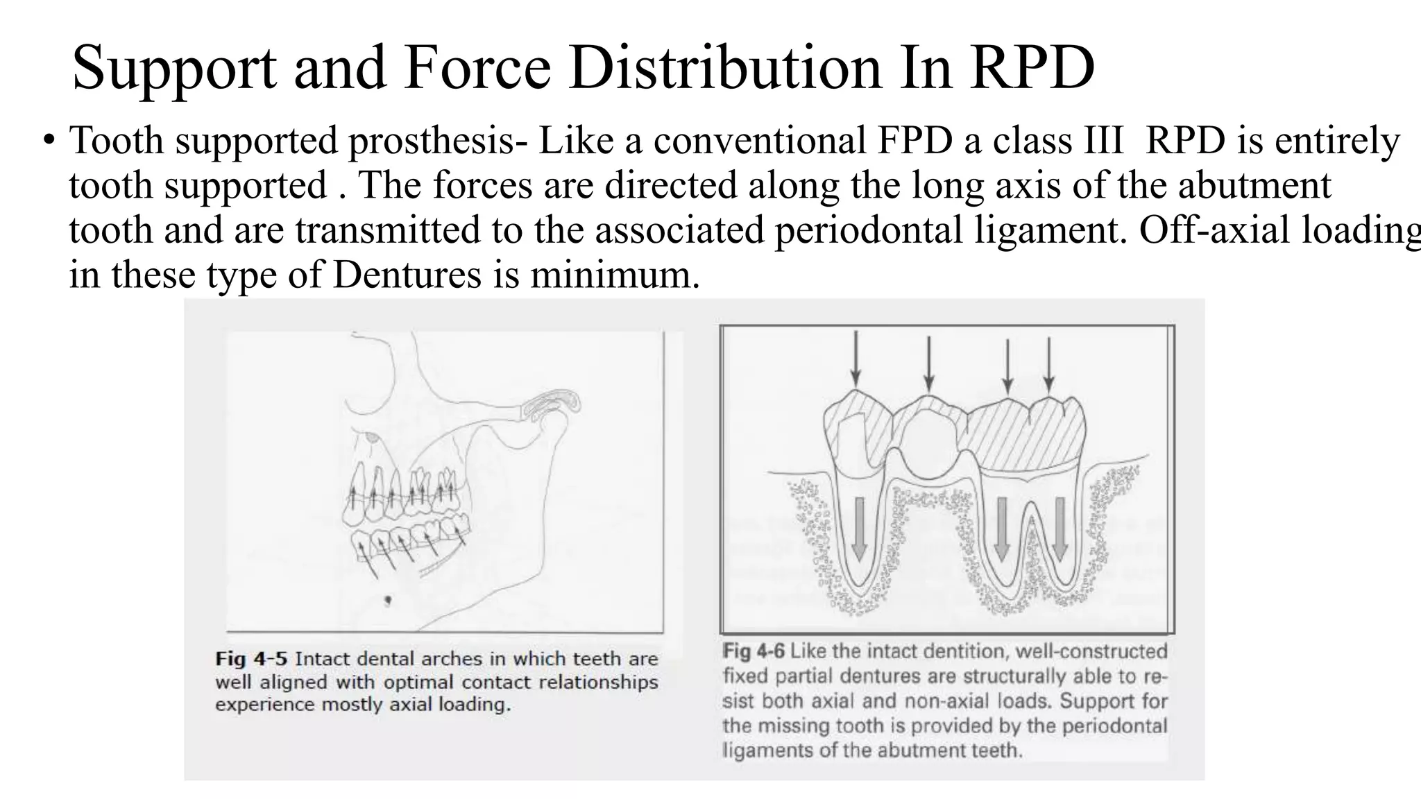 Principles of RPD designing | PPTX