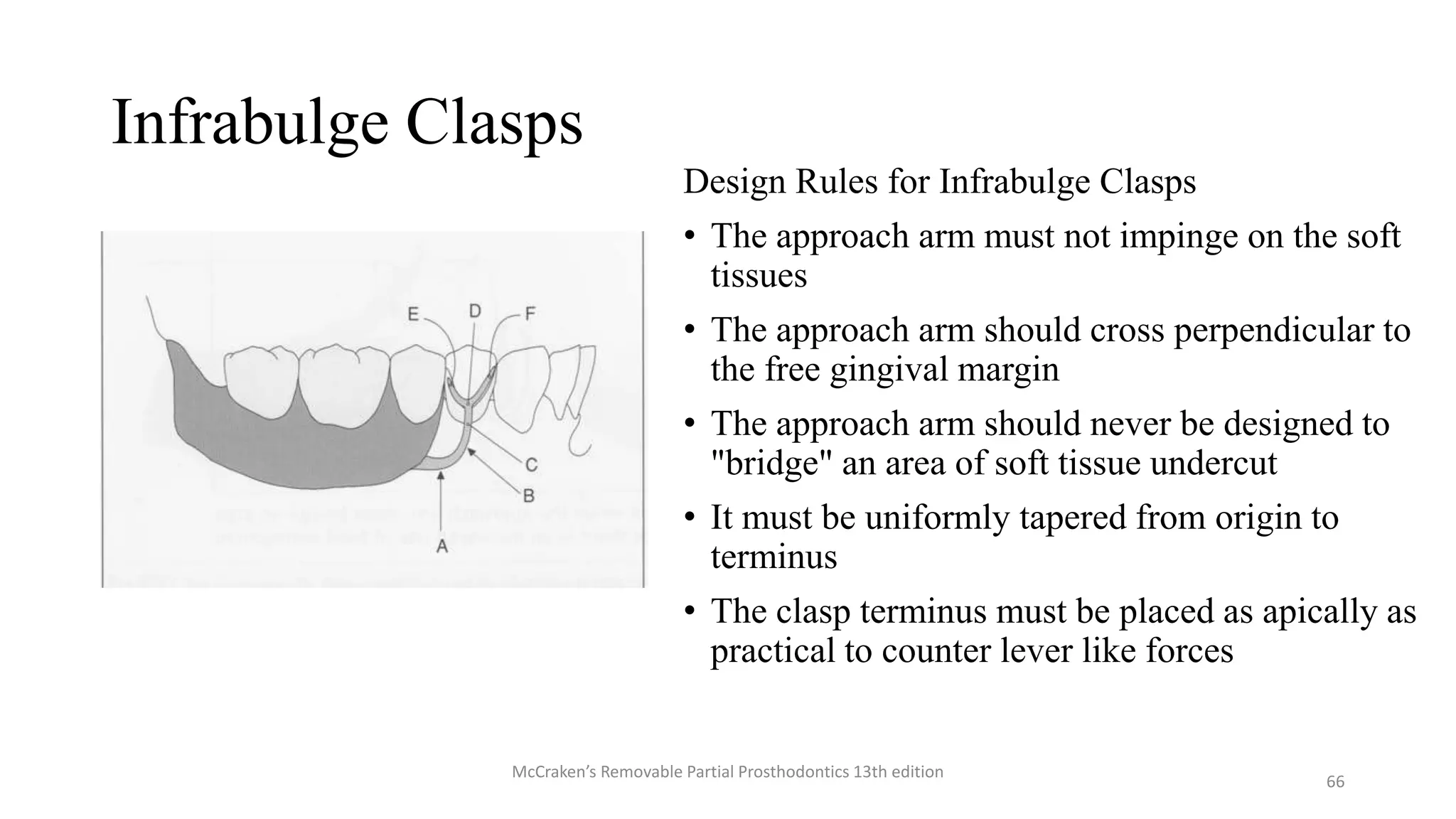 Principles of RPD designing | PPTX