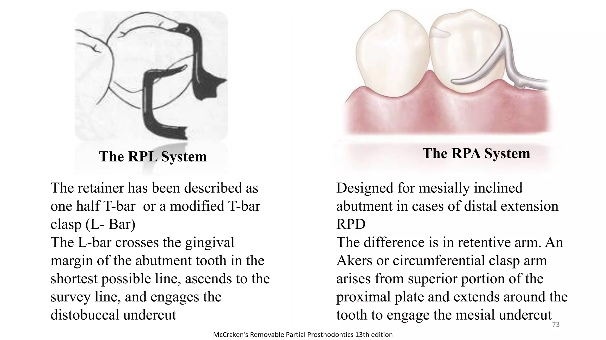 Principles of RPD designing | PPTX
