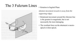 Principles of RPD designing | PPTX