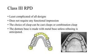 Principles of RPD designing | PPTX