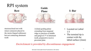 Principles of RPD designing | PPTX