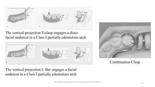 Principles of RPD designing | PPT