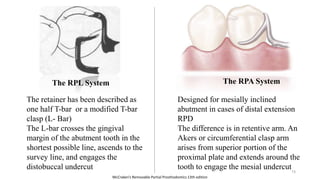 Principles of RPD designing | PPT