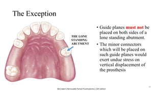 Principles of RPD designing | PPT