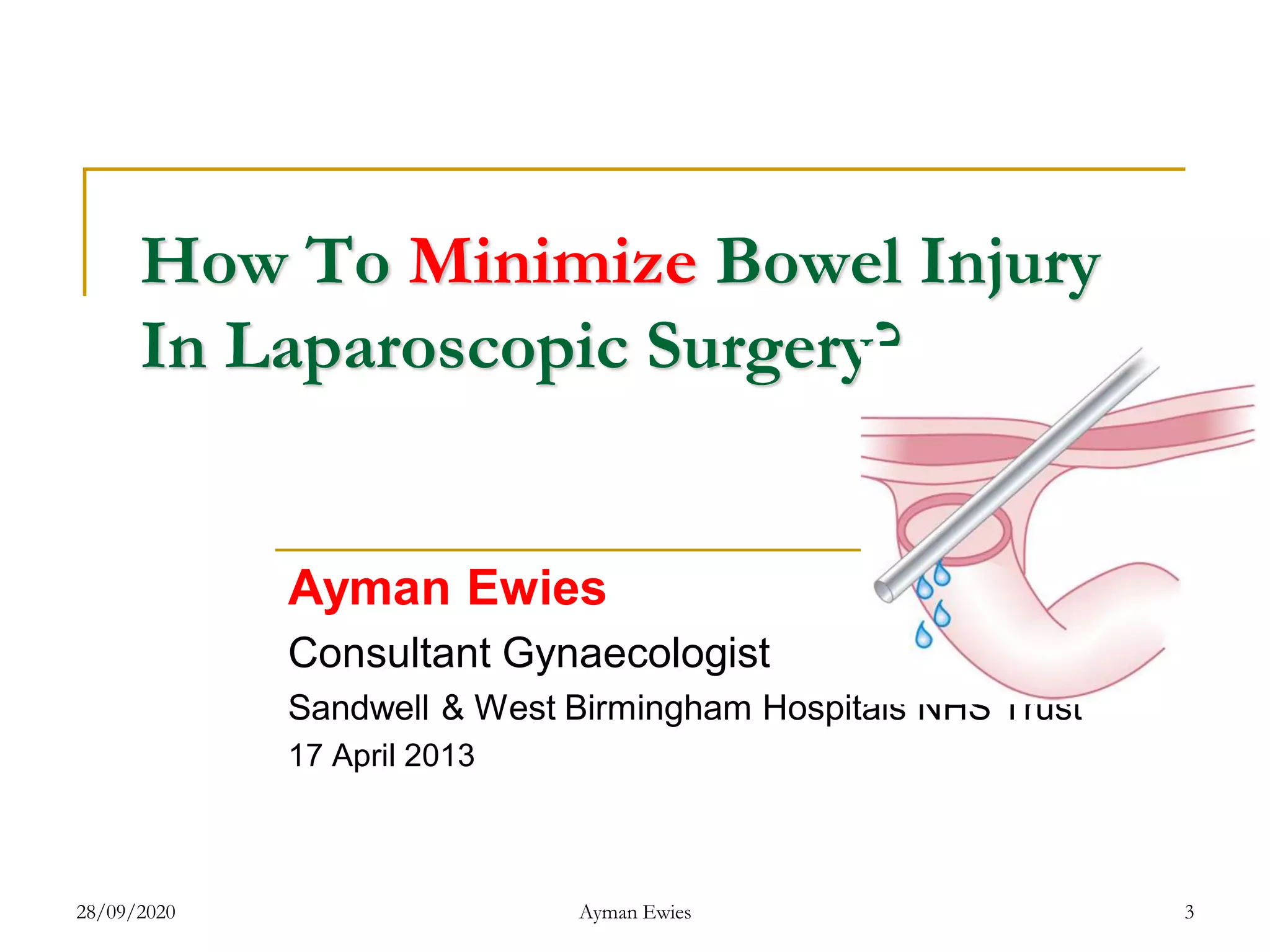 Dr Ayman Ewies - Principles of Safe Laparoscopic Entry | PDF