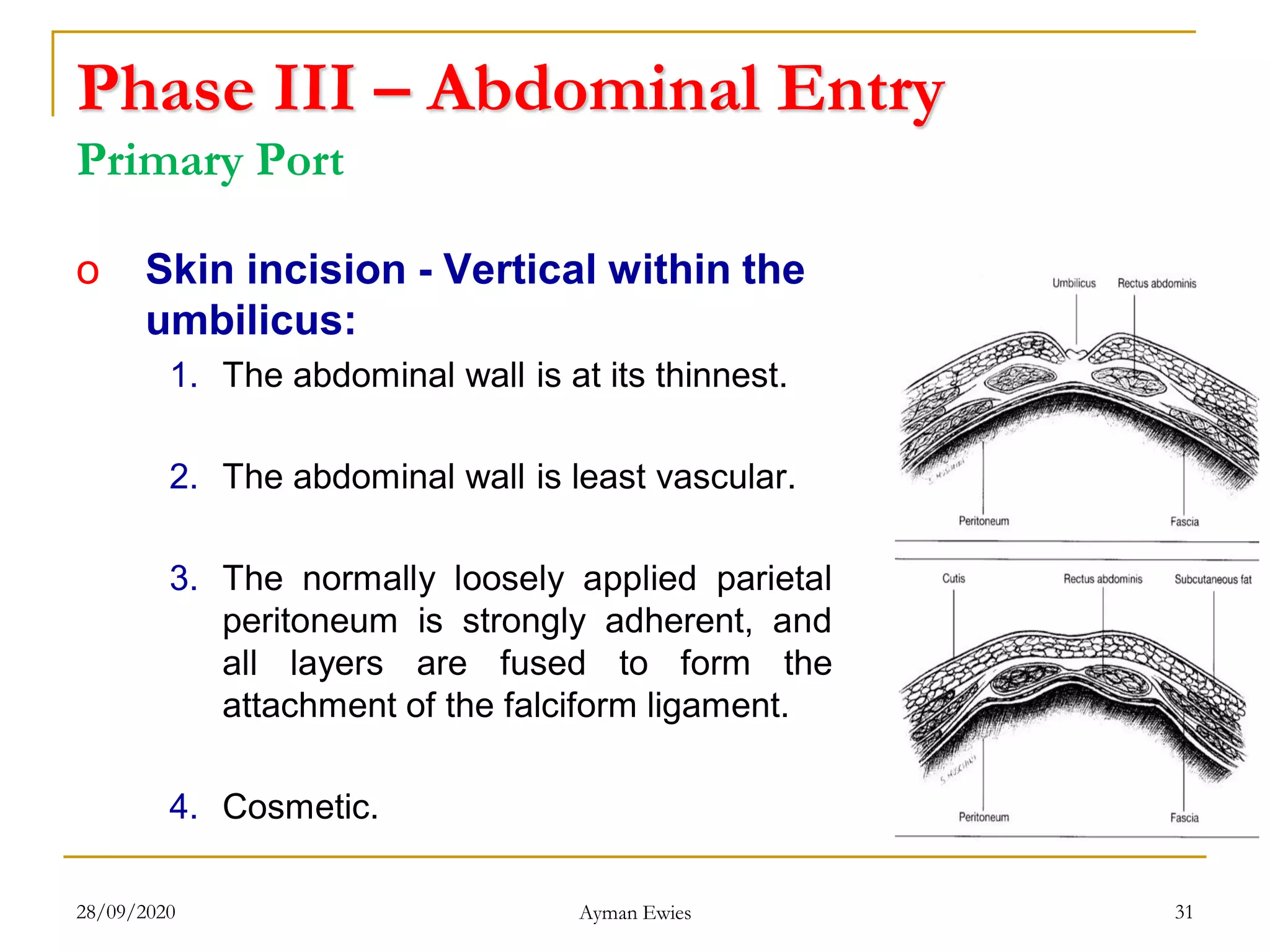 Dr Ayman Ewies - Principles of Safe Laparoscopic Entry | PDF