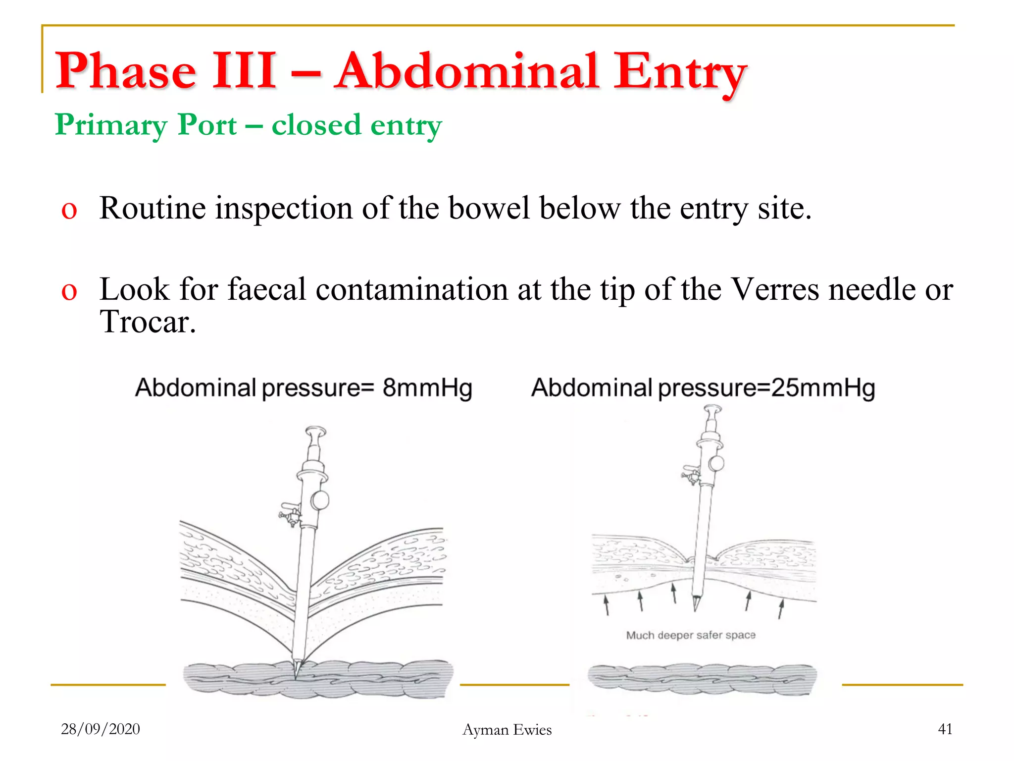 Dr Ayman Ewies - Principles of Safe Laparoscopic Entry | PDF