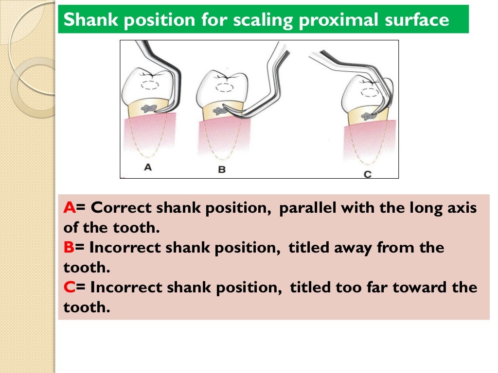 Principles of scaling & root planing dr alaa attia Principles of scaling & root planing dr alaa attia