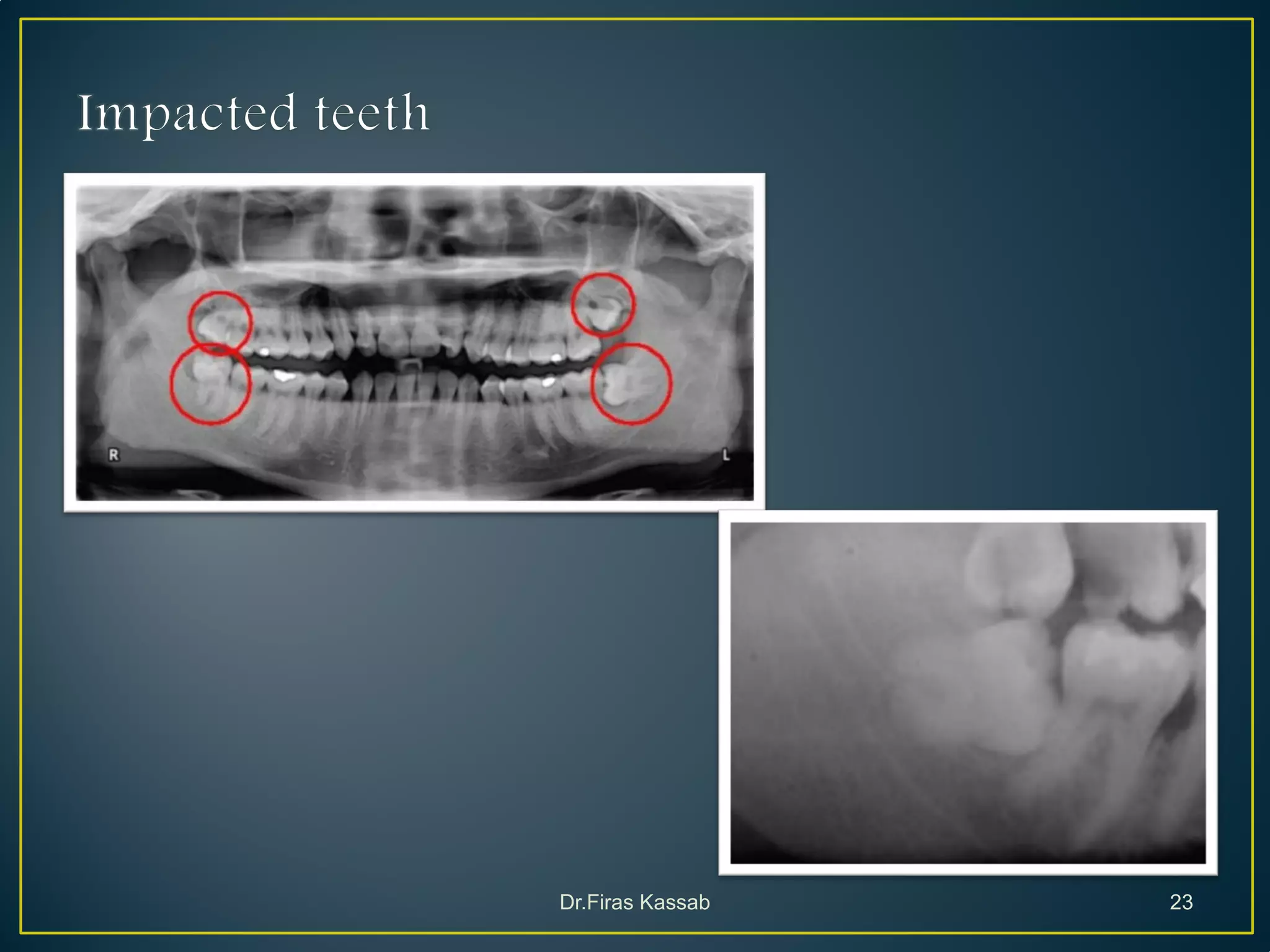 Principles of simple extractions 1 | PDF
