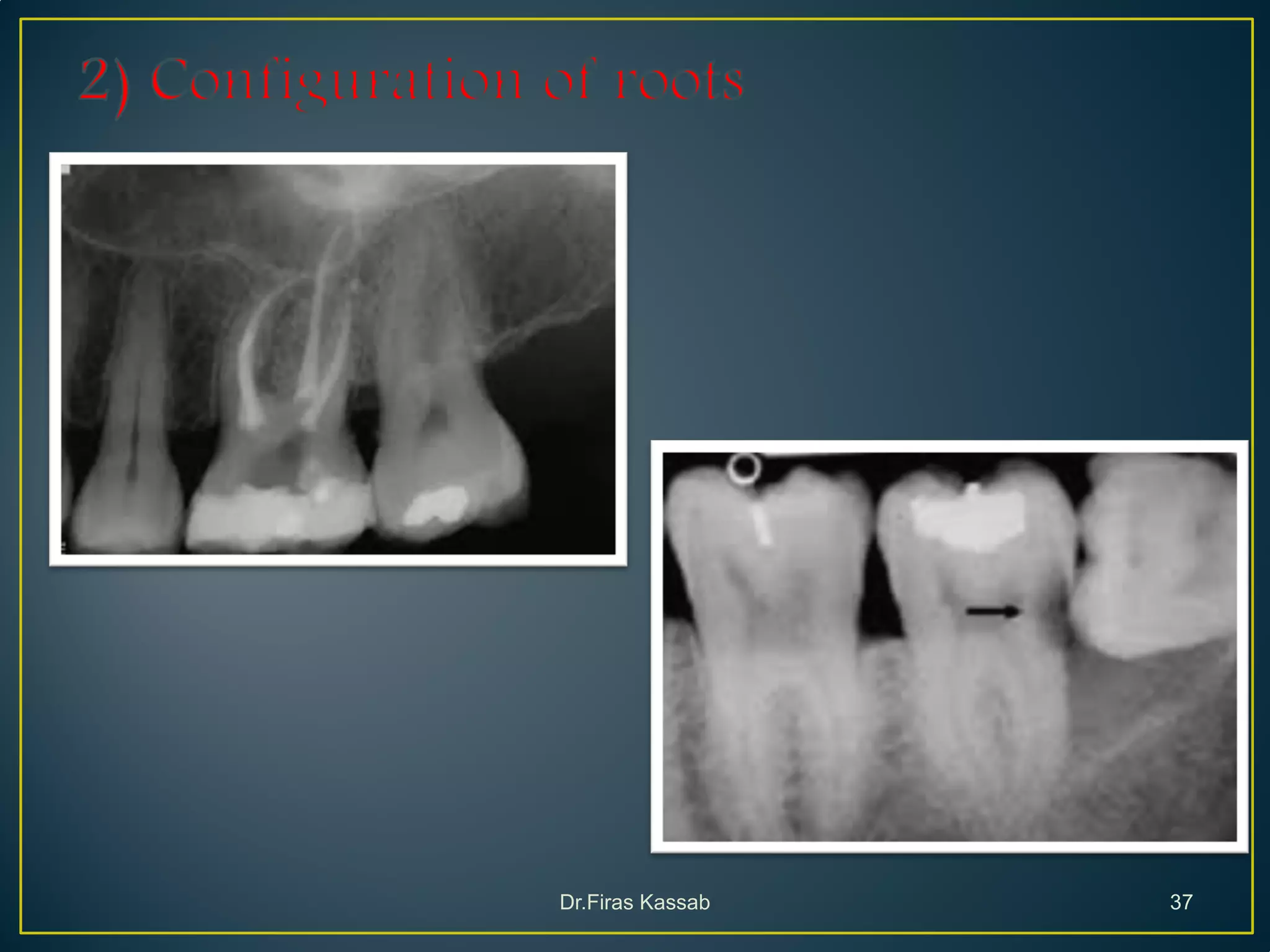 Principles of simple extractions 1 | PDF