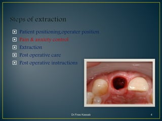 Principles of simple extractions 1 | PDF