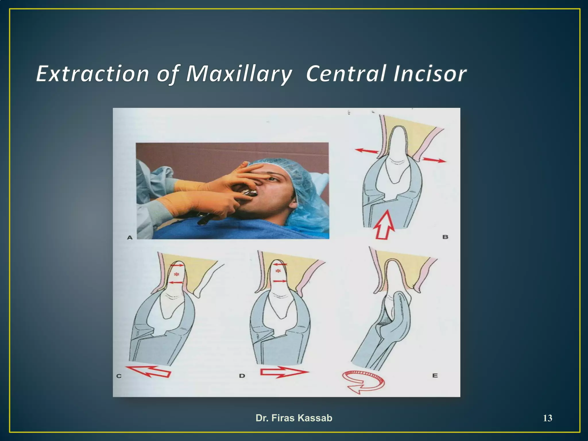 Principles of simple extractions 2 | PDF