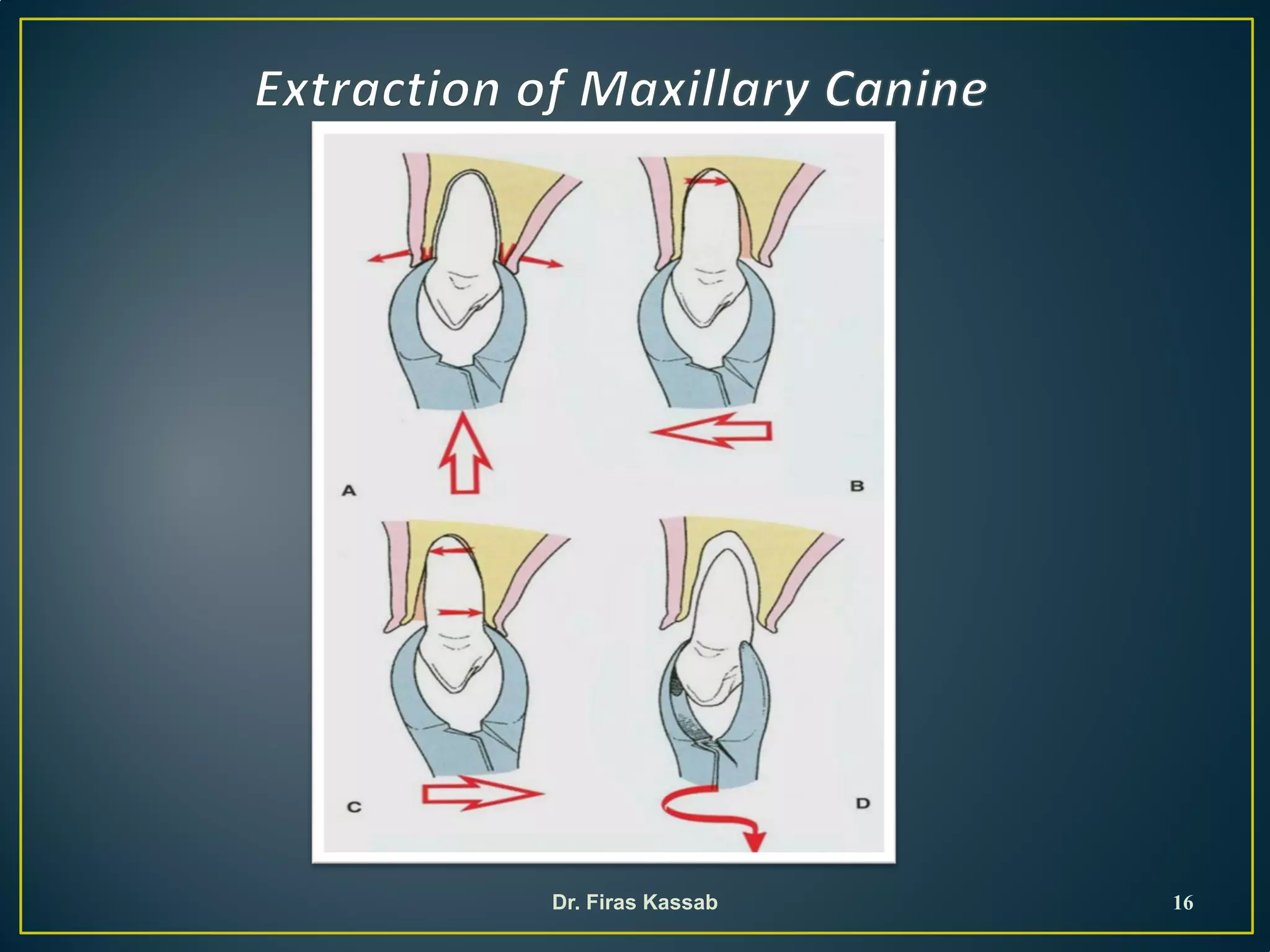 Principles of simple extractions 2 | PDF