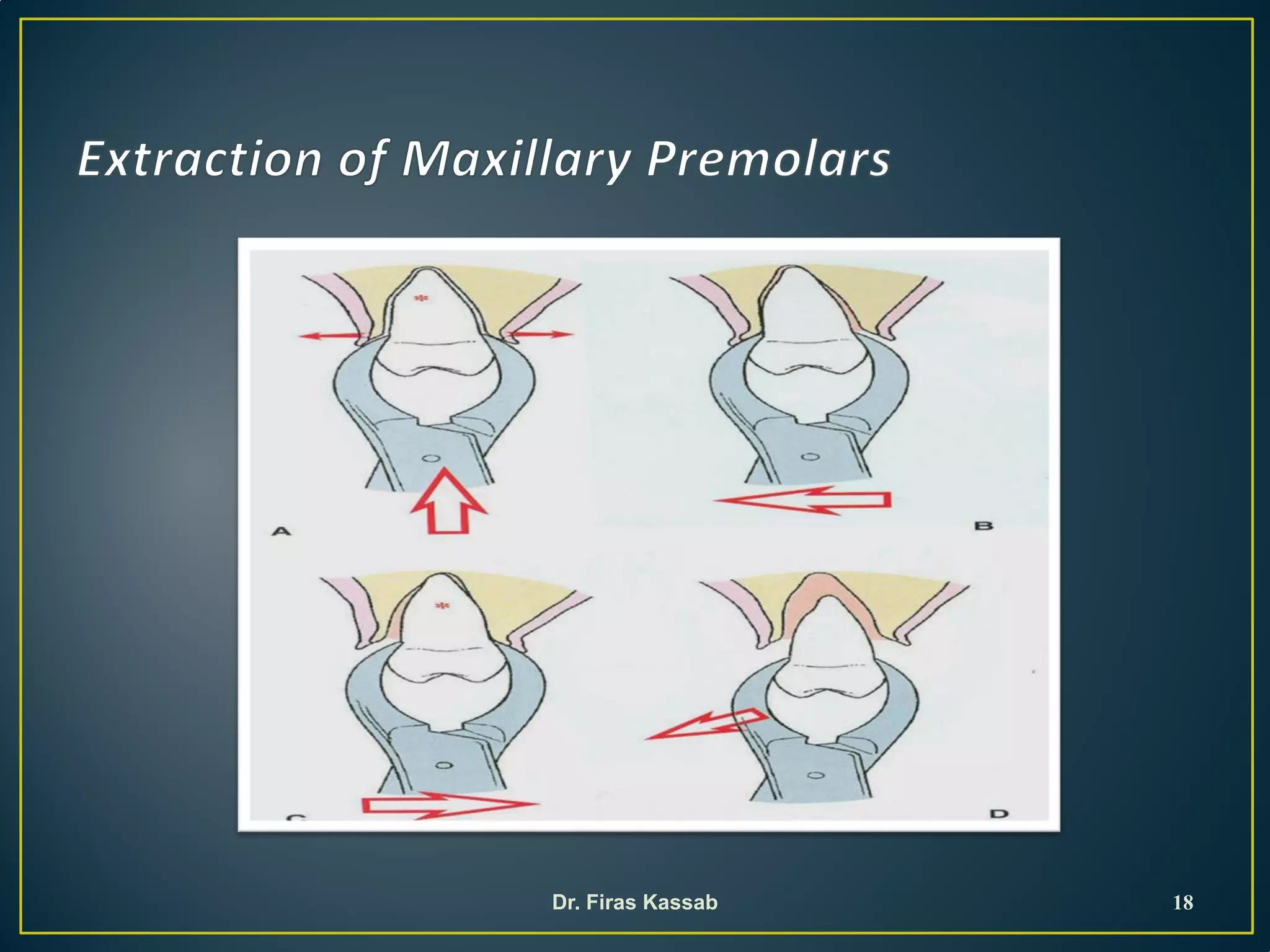 Principles of simple extractions 2 | PDF