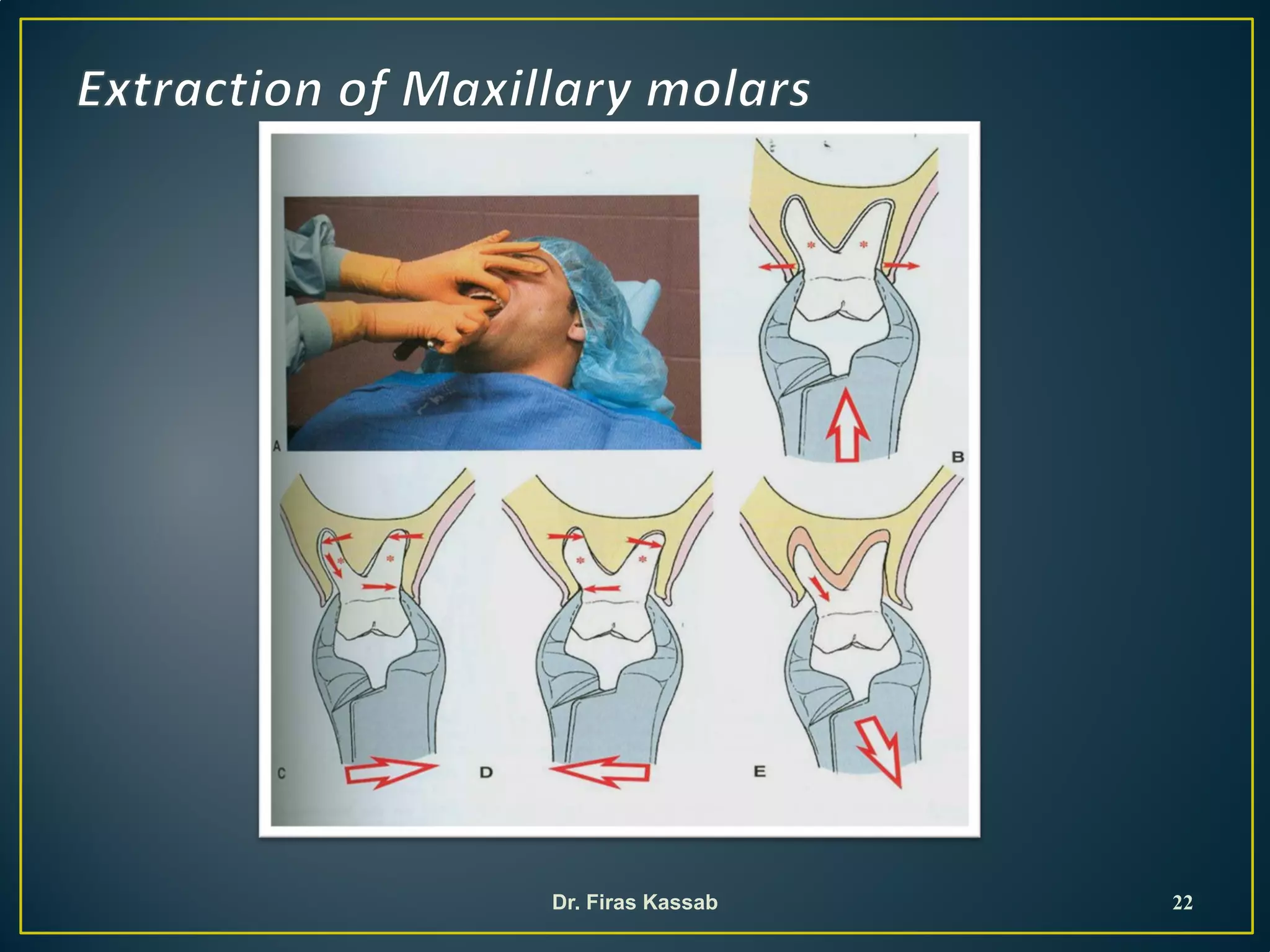 Principles of simple extractions 2 | PDF
