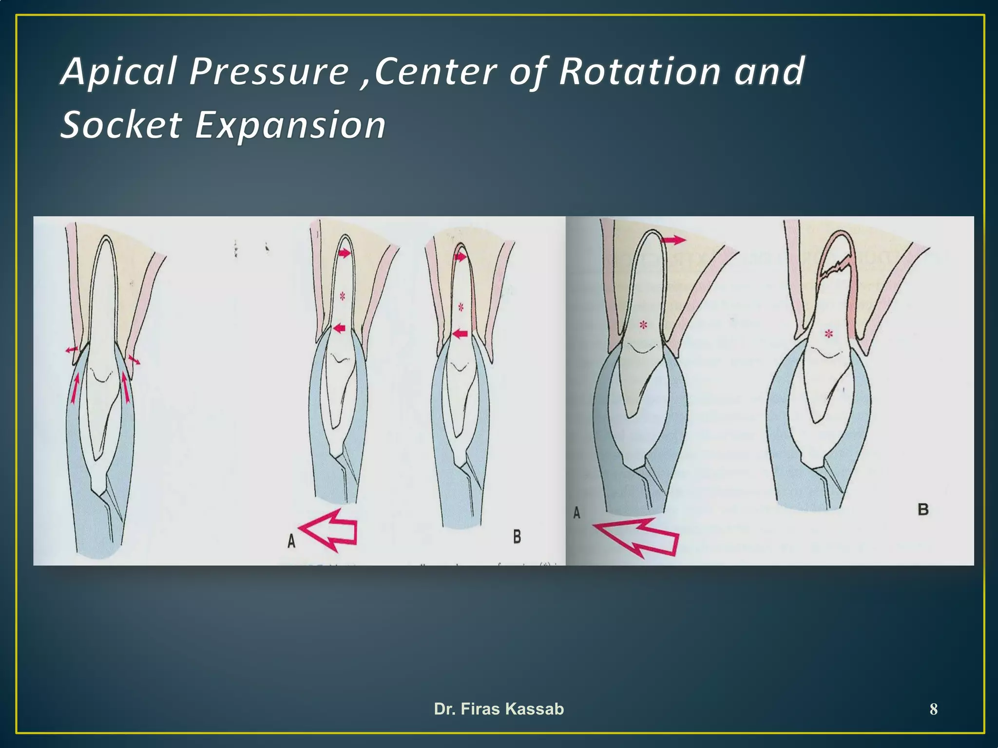 Principles of simple extractions 2 | PDF