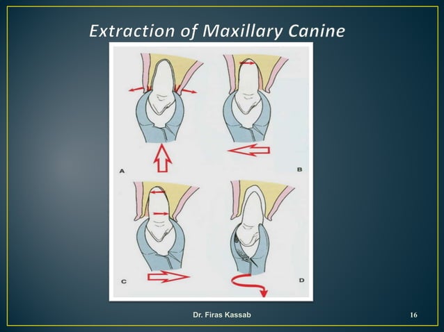 Principles of simple extractions 2 | PDF | Dental Health | Diseases and ...