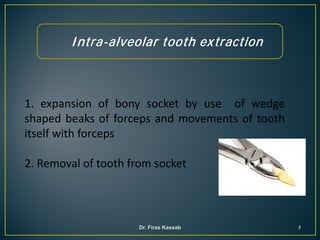 Principles of simple extractions 2 | PPT