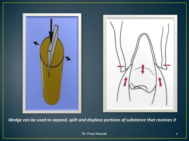 Principles of simple extractions 2 | PDF | Dental Health | Diseases and ...