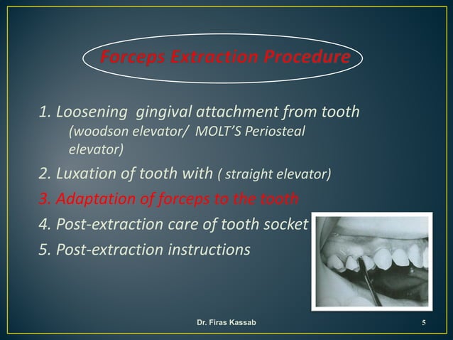 Principles of simple extractions 2 | PDF | Dental Health | Diseases and ...