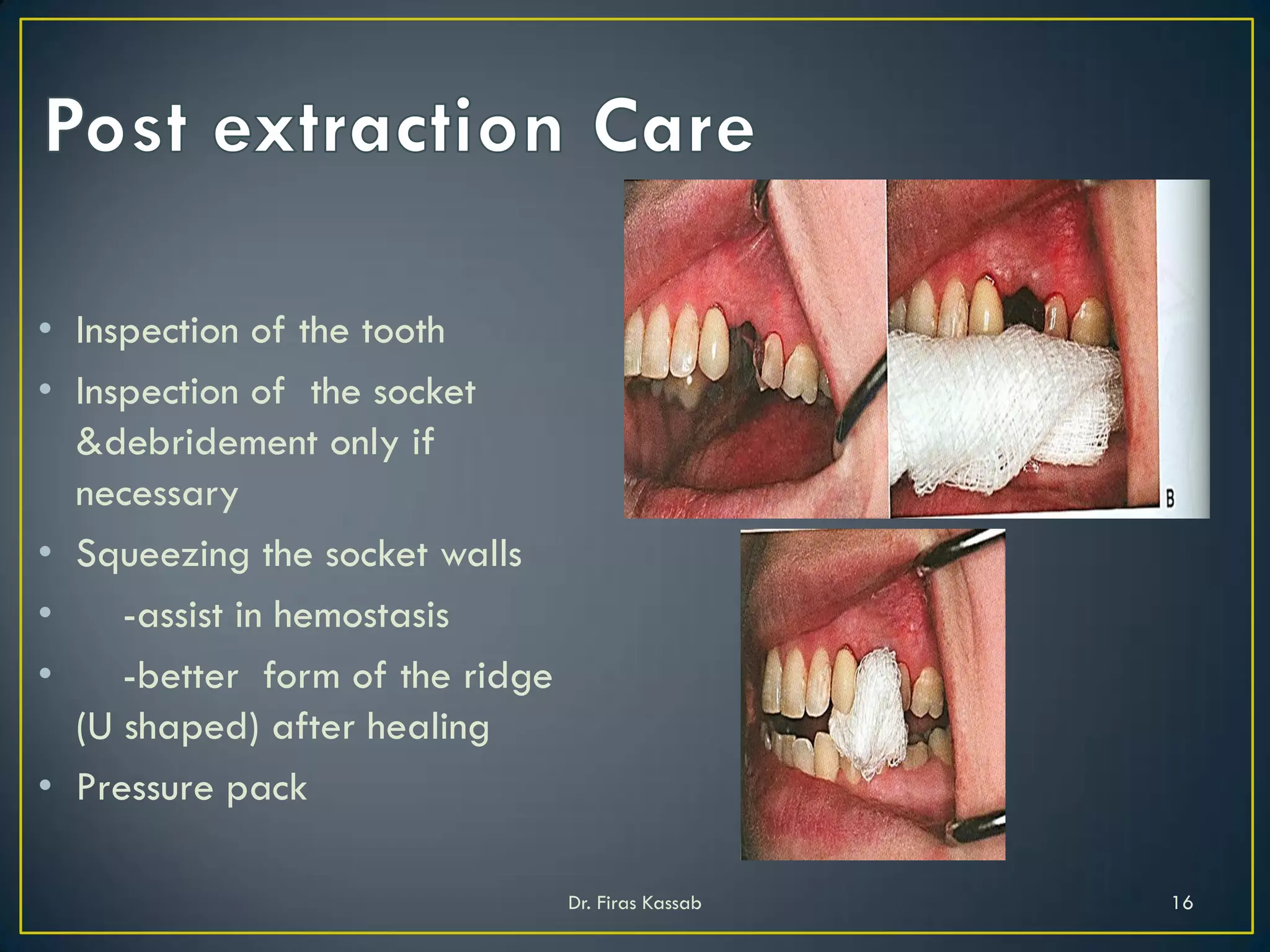 Principles of simple extractions 3 | PPT