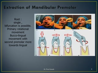 Principles of simple extractions 3 | PPT