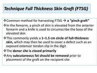 PRINCIPLES of SKIN GRAFT and FLAP.ppt